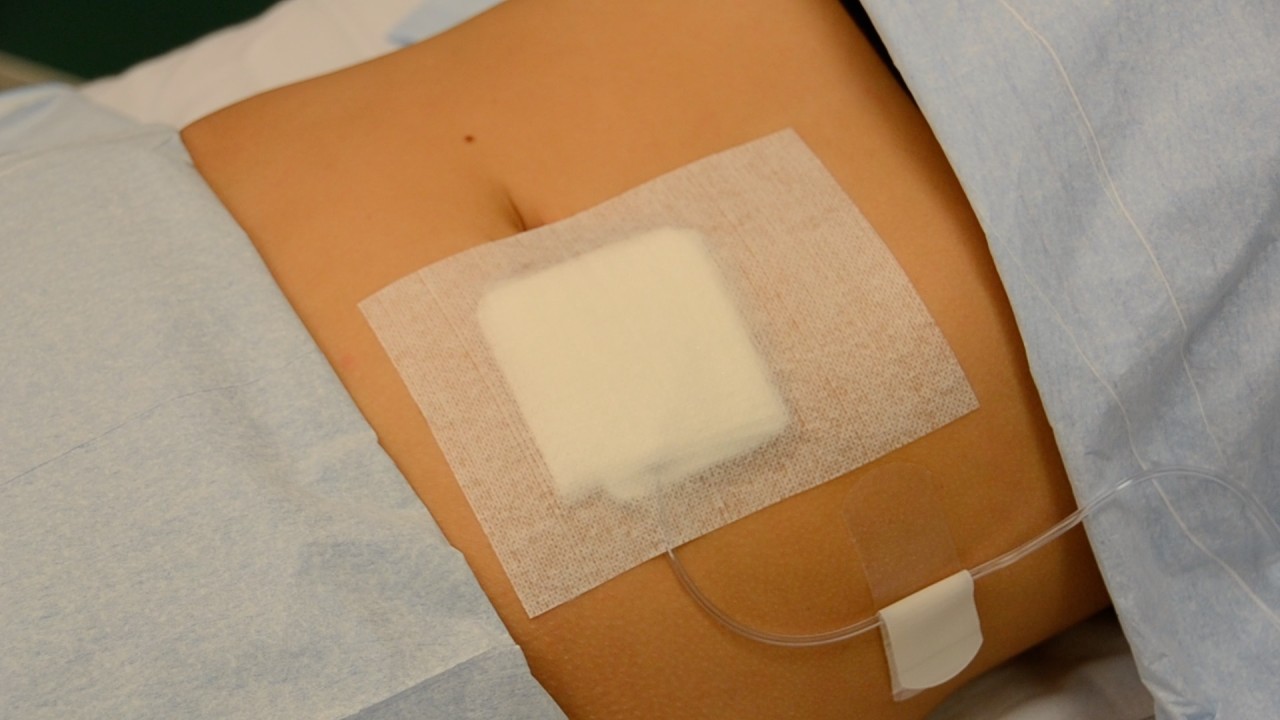 Fixiersysteme - Spezialisierte Fixierlösungen für medizinische Zu- und ...