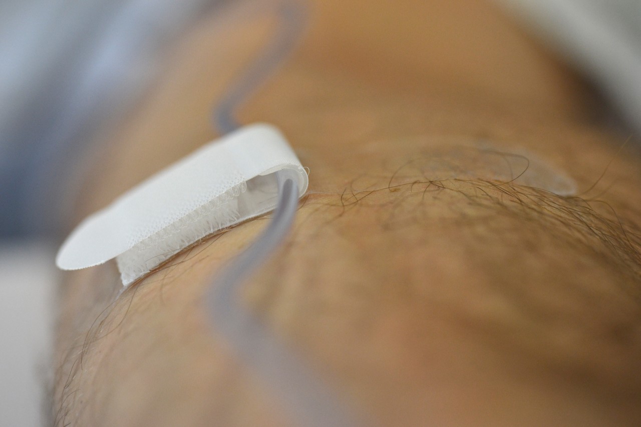 Transafix Fixierstreifen No. 2 | unsteril | 8700250